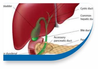 Hepato Pancreato Biliary Surgery in Nagpur - Asha Hospital